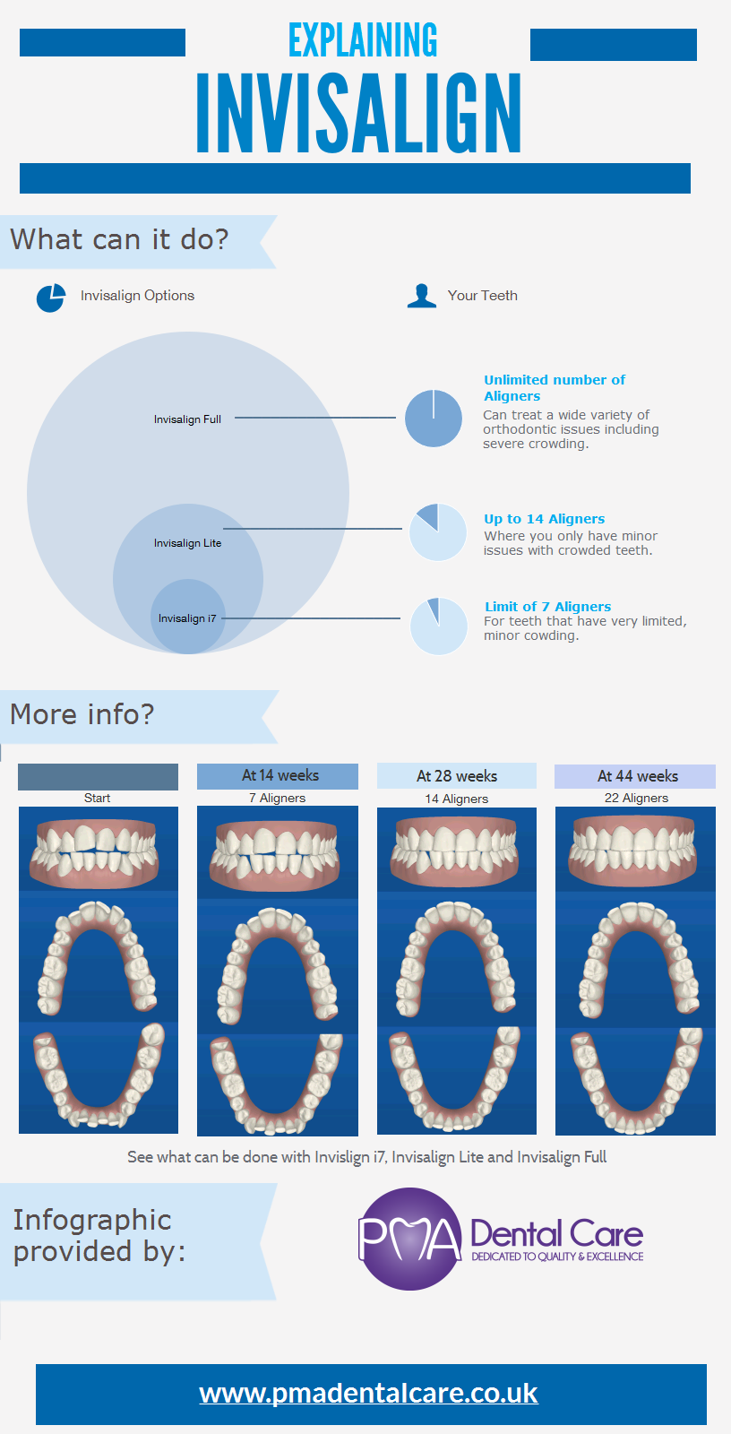 Invisalign Frequent Questions Pma Dental Care Dentist Gravesend Kent